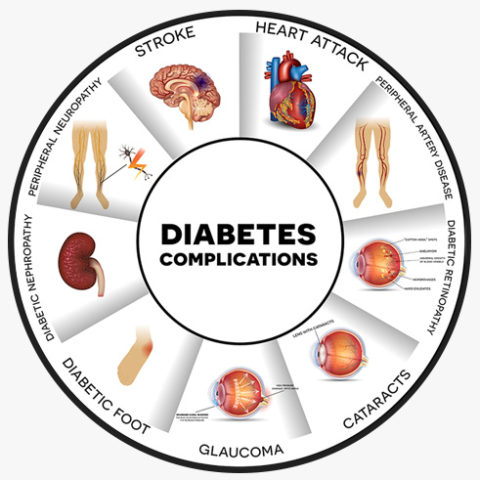 Diabetes And Its Effects: Long Term Effects On The Body