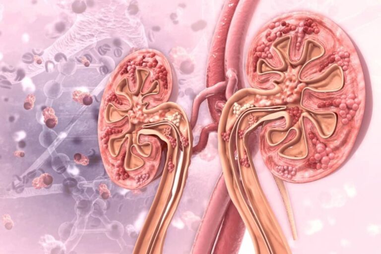 Diabetic Kidney Disease (DKD) | Diabetic Nephropathy