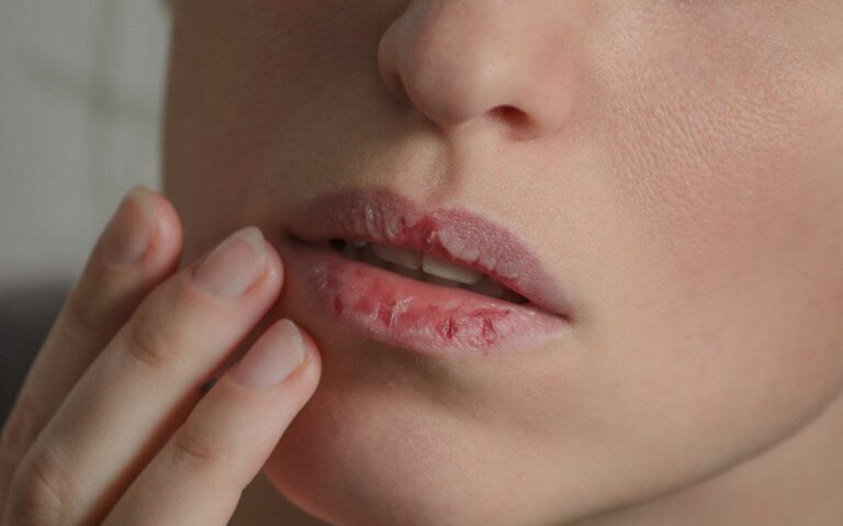 Signs of Type 2 Diabetes: Early And Later Warning Signs