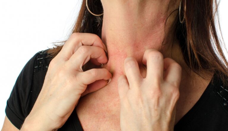 Diabetes And Skin Conditions: Tips For Preventing Them