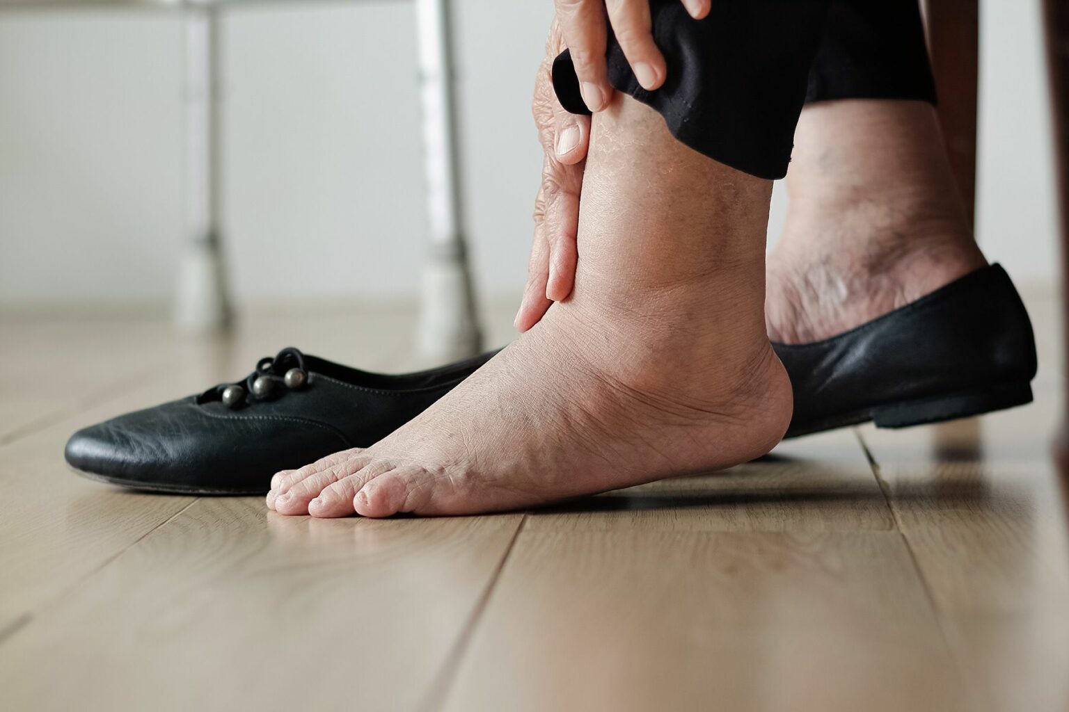 Causes Of Fluid Retention: Definition, Causes And Solutions