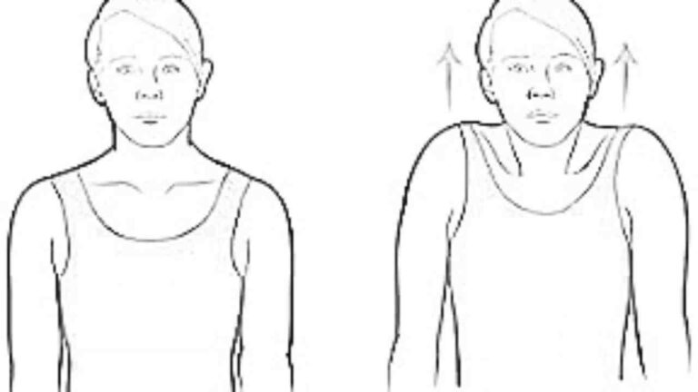 Multidirectional Instability Shoulder: All You Need To Know